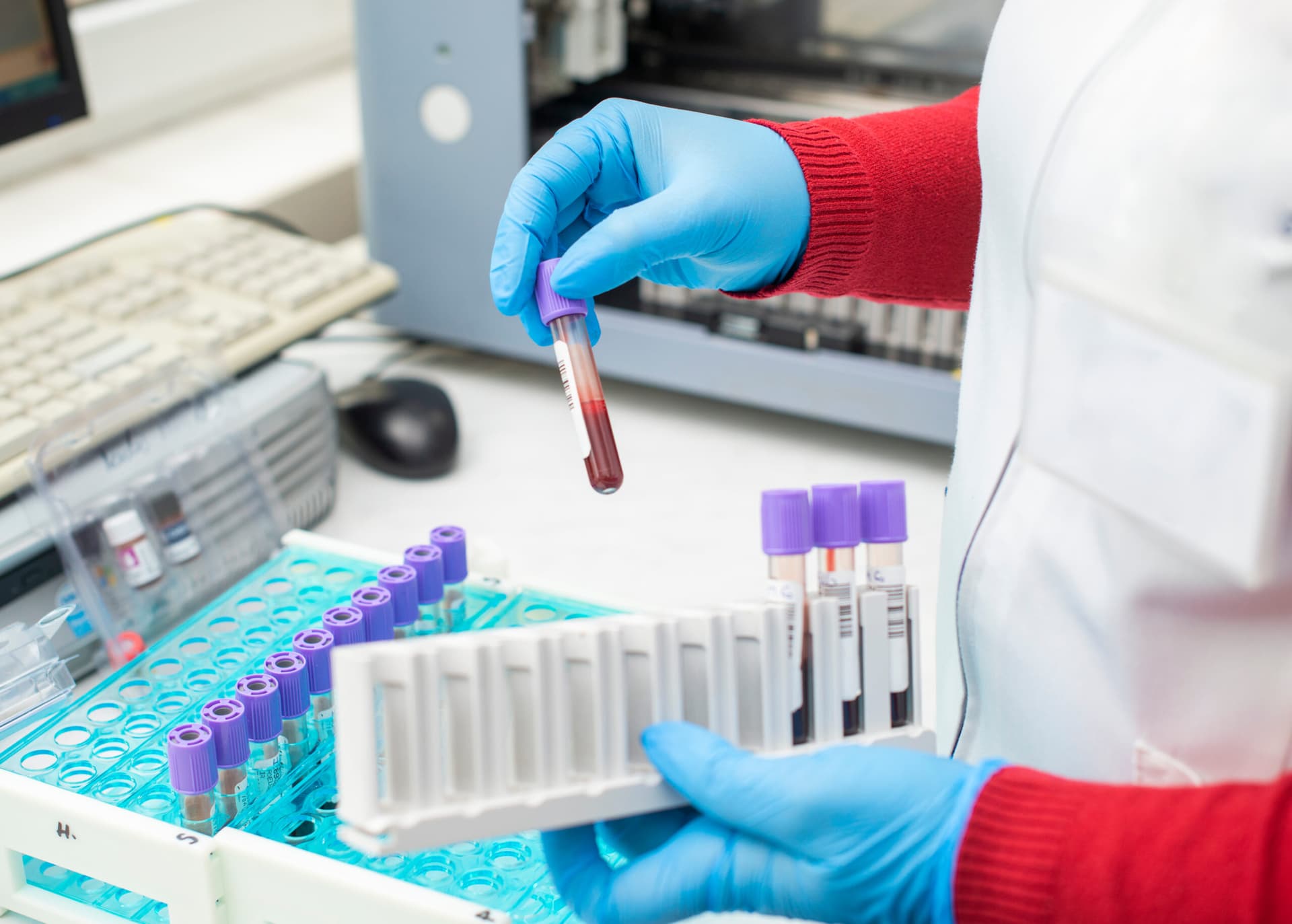 Blood Drug Test: Purpose, Types, and Procedure | Zinnia Health