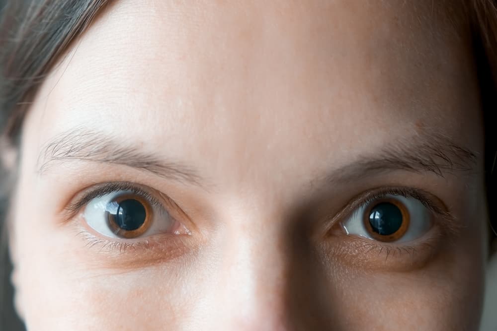 High Eyes: How Pupil Size Can Show Someone Is High on Weed | Zinnia Health